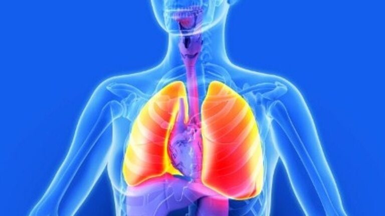 Polmonite: comprendere il ruolo cruciale degli alveoli nel processo ...