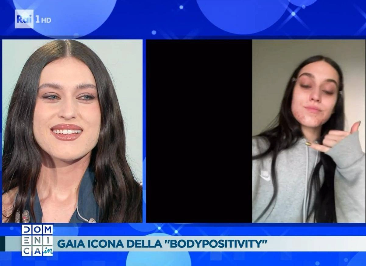 Gaia Gozzi parla di body positivity e acne: la sfida della bellezza naturale in diretta